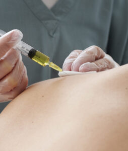 Botox for Trap (Trapezius Muscle) – Hudson Dermatology and Laser Surgery
